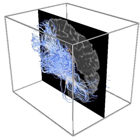 Scientific Visualization And Computer Graphics