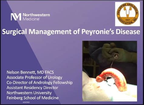 Surgical Management Of Peyronies Disease Philippine Urological