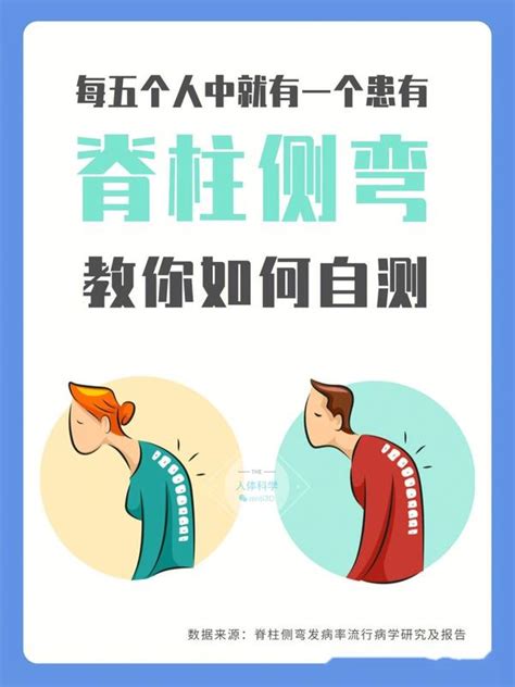 脊柱侧弯脊柱侧弯的自我检测方法 知乎