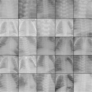 Comparison Of Images With Largest VoGs For ResNet 18 And ResNeXt 101