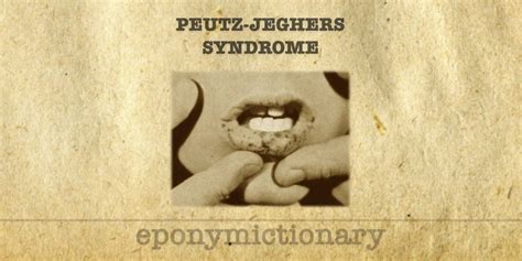 Peutz Jeghers Syndrome • Litfl • Medical Eponym Library