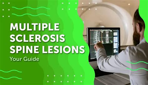 Multiple Sclerosis Spine Lesions Your Guide Mymsteam