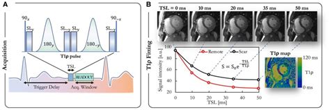 assessment of myocardial injuries in ischaemic and non ischaemic