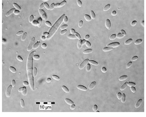 Microconidia Of Fusarium Fusarium Oxysporum