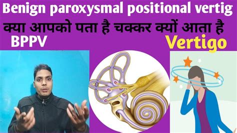 Bppv Bppv Symptoms Testandtreatment चक्कर आने का क्या कारण है। Benign Paroxysmal Positional