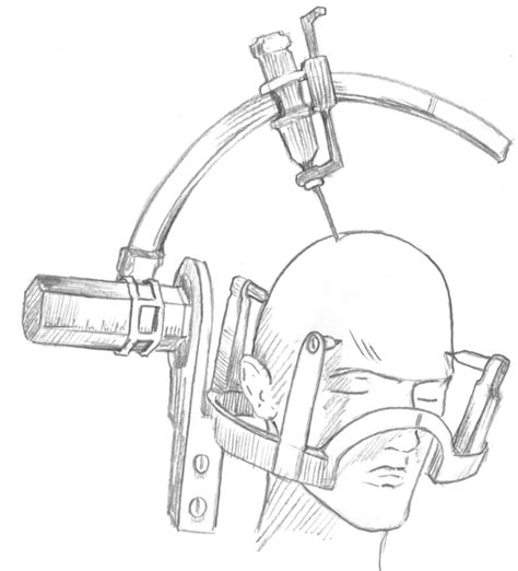 3 Stereotactic Biopsy Download Scientific Diagram