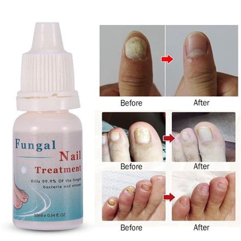 Moisturizing Nail Polish Onychomycosis Nail Repair Liquid Nourishing