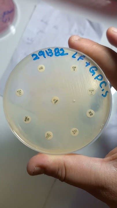 Gpc S Bacteria Microbes Lab 1millionview Gpc Giantmicrobesinc Youtube