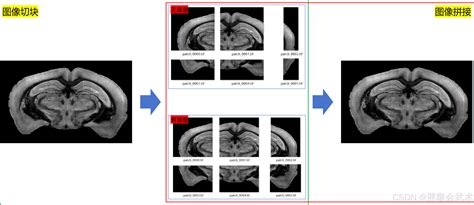 医学影像 图像拼接（image Stitching） Csdn博客