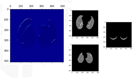 Github Krishvramanpredicting Lung Function