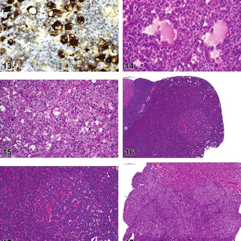 Mouse Thyroid Gland Hyperplasia Follicular Cell Focal With Piling Up Download Scientific