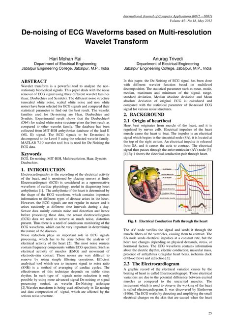 Pdf De Noising Of Ecg Waveforms Based On Multi Resolution Wavelet