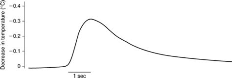 Thermodilution Cardiac Output Co