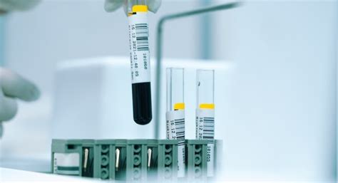 Flomics Press Release Pcpp 2022 Flomics