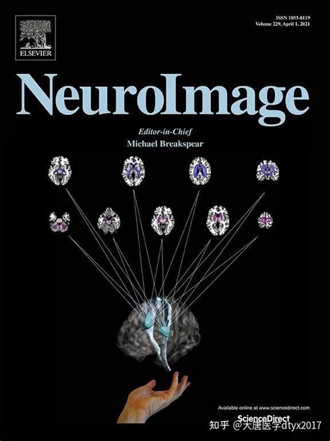 Neuroimage（神经影像）英文期刊杂志pdf 半月刊 更新到2021年第11期 知乎