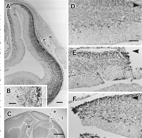 Figure 1 From Origin And Route Of Tangentially Migrating Neurons In The Developing Neocortical