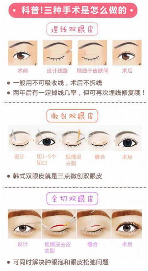 双眼皮图片哪种好看 哪种双眼皮好看 4种双眼皮类型图片 大山谷图库