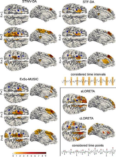 Figure 1 From Eeg Extended Source Localization Tensor Based Vs Conventional Methods Semantic