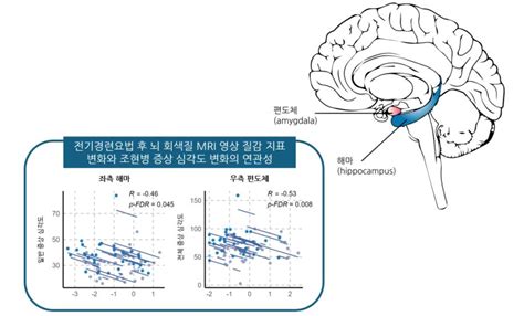 서울대학교병원