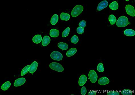 lamin a c antibody cl488 81042 proteintech