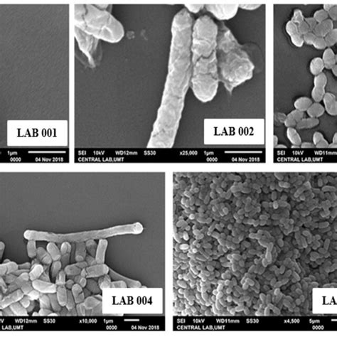 Sem Observation On Lab Isolates Lab 001 Lab 002 Lab 004 And Lab 005