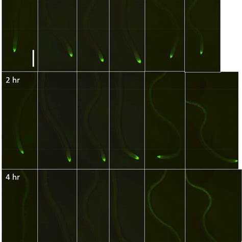 Fluorescence Stereomicrographs Displaying Gfp Expression Of Tcsngfp