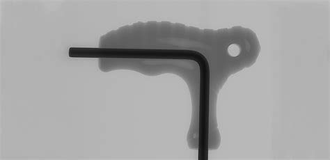 Digital Radiography Or3d