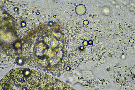 Green Mucus And Coughing Up Phlegm Under The Microscope Looking At