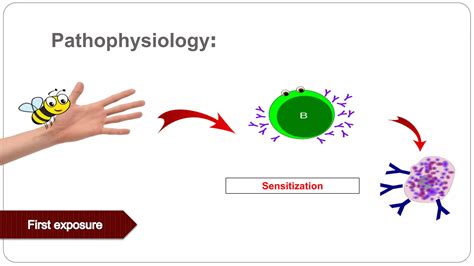 Anaphylactic Shock Pptx