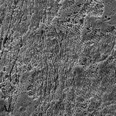 Enamel Etching Pattern Type 1 Honeycomb Appearance A Magnification Download Scientific