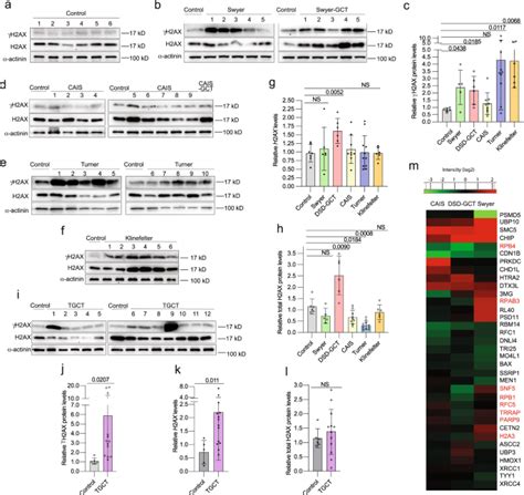 患有性别决定缺陷和生殖细胞癌的个体的基因组不稳定性 Cell Death Discovery X Mol