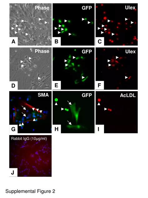 PPT Immunofluorescence Analysis Of Ulex Phase In Cultured Cells PowerPoint Presentation ID