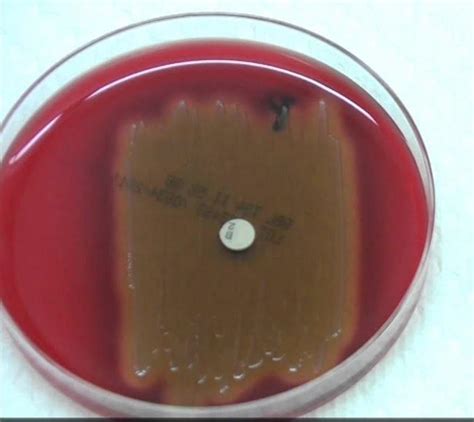 Solved Clinical Microbiology Below Is A Bacitracin A Disk