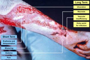 Short And Long Term Effects Of Radiation Exposure Rcemlearning Emfp