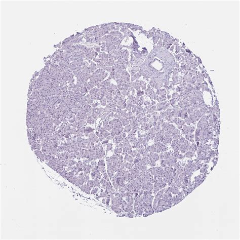tissue expression of cep120 staining in pancreas the human protein