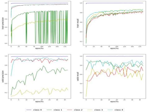 Figure 1 From Brain Tumor Segmentation Based On 3d Unet With Multi Class Focal Loss Semantic