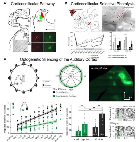 Figure 3 From When And How Does The Auditory Cortex Influence