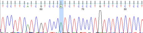 Chromatogram Result For One Case Download Scientific Diagram