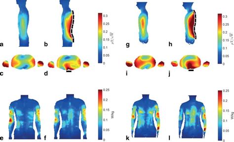 Quadrature Transmit Fields And Specific Absorption Rates Simulated