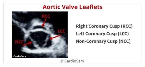 Aortic Valve Echo