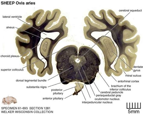 Atlas Of The Sheep Brain Section Image