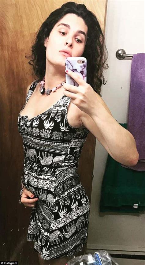 Transgender Woman Reveals Gender Confirmation Surgery Is Like Daily