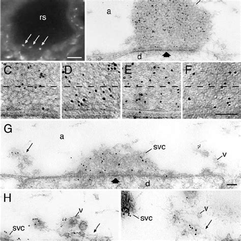 Distribution Of Synapsin And Actin In Active Synapses As Revealed By