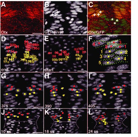 Single Nucleus Tracking Procedure A C Nuclei Can Be Identified In