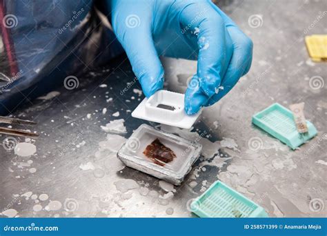 Scientist Embedding Tissues In Paraffin Blocks For Sectioning Pathology Laboratory Stock Image