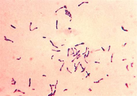 Corynebacterium Diphtheriae Vircell