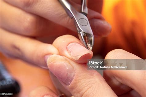 Cuticle Circumcision With Forceps Closeup The Process Of Selfmanicure