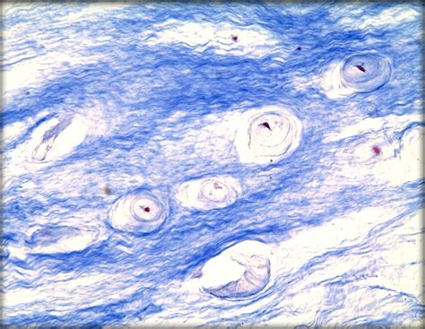 Fibrocartilage Examples