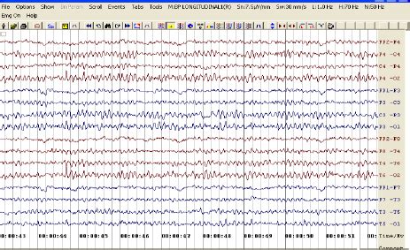 Channel EEG Data Plots Download Scientific Diagram