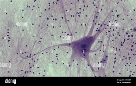 Nervous Tissue Slide Neuron Multipolar Neuron Basic Cell Of Nervous